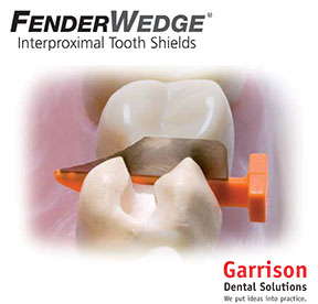 Tooth shield aids in minimally invasive dentistry | Garrison Dental