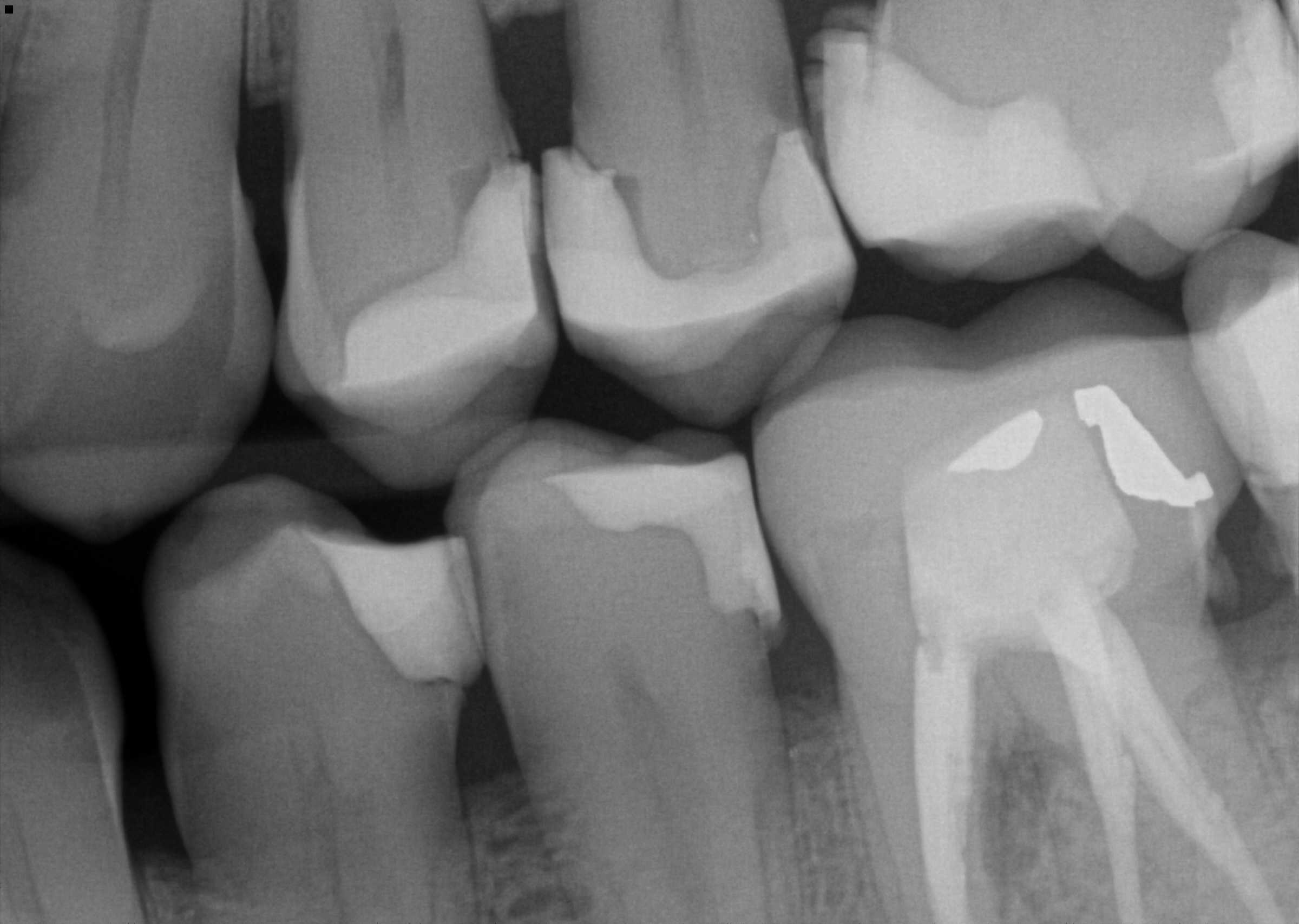 Advanced design for complex cases | Quad Matrix System™