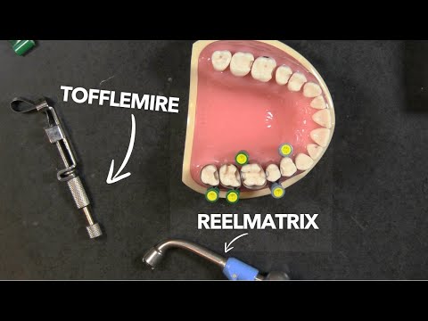 Garrison ReelMatrix | Retainerless Circumferential Matrix System