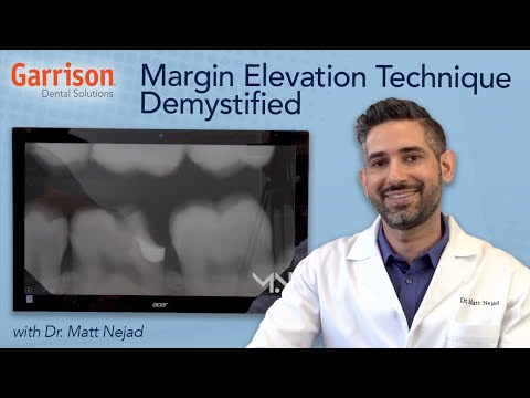 ReelMatrix™ and Deep Margin Elevation Kits