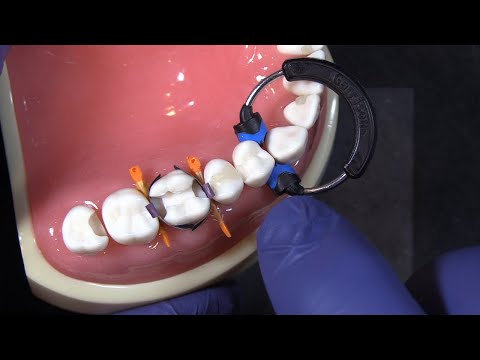 Composi-Tight® 3D XR Sectional Matrix System Kit