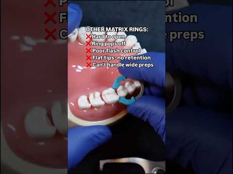 Strata-G™ Matrix Rings