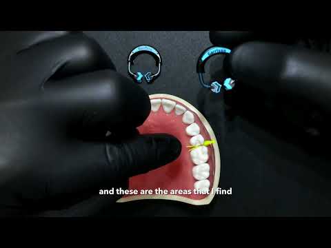 Quad Sectional Matrix System Deluxe Kit (QR-KHF-14)