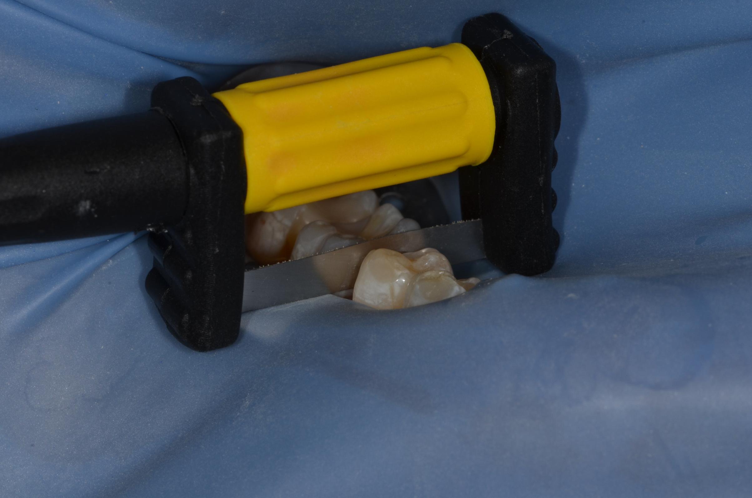 FitStrip™ Interproximal Finishing and Contouring Kits